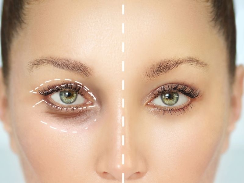 Эстетика век - Op. Dr. Yusuf Can